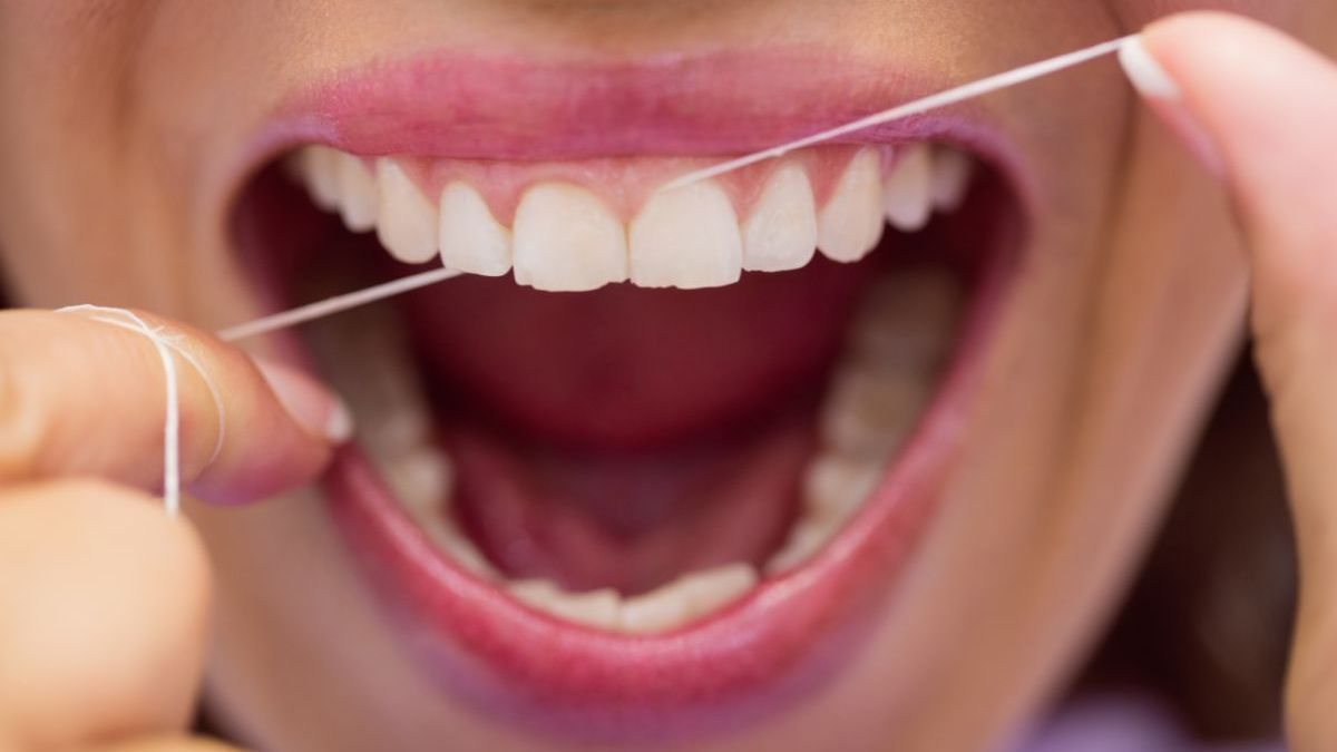 Pesquisa aponta que uso diário do fio dental reduz risco de AVC