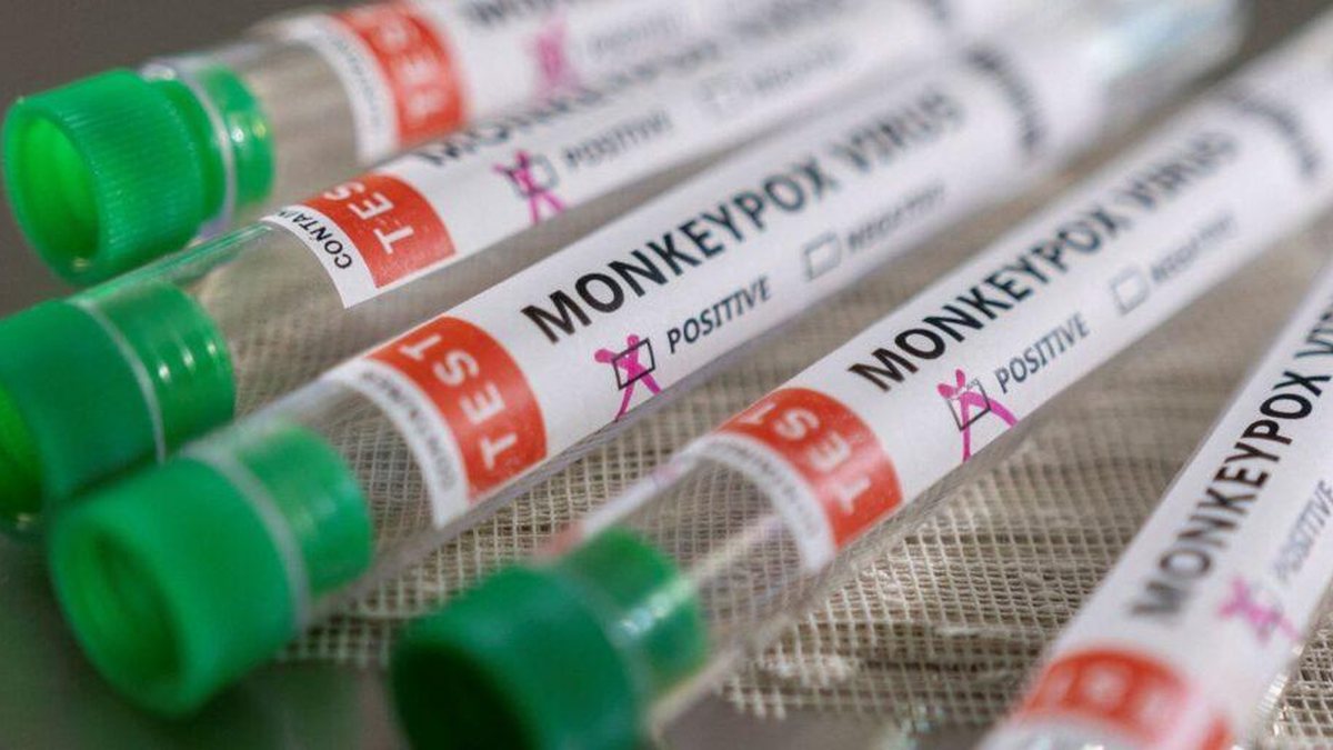 Ministério da Saúde confirma nono caso de varíola dos macacos no país